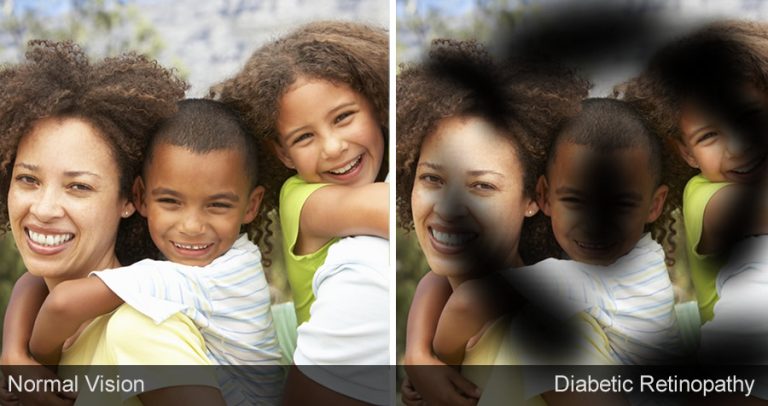 Diabetic Retinopathy - Billings Retina and Macula